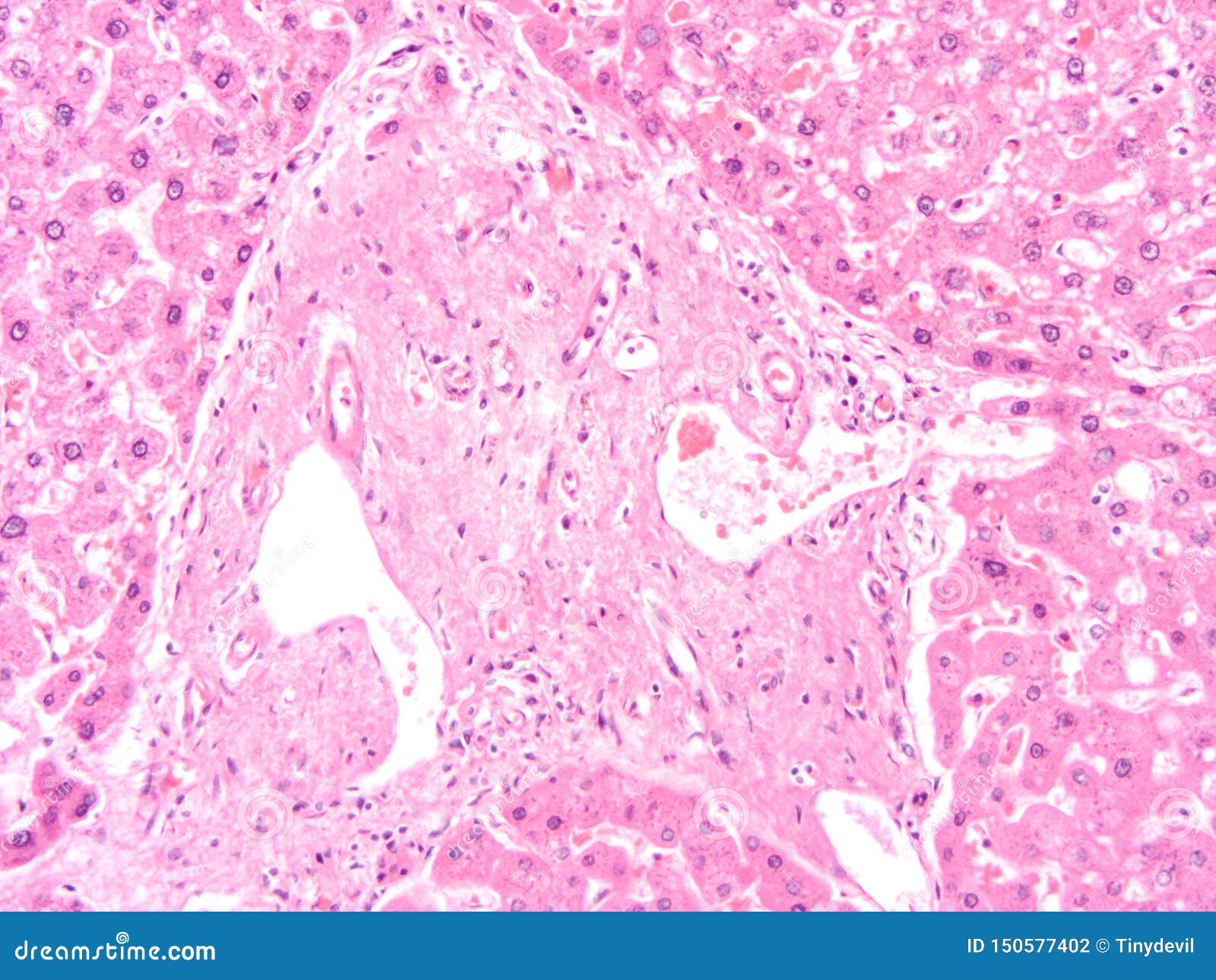 Histology of Human Liver Tissue Stock Photo - Image of physiology ...