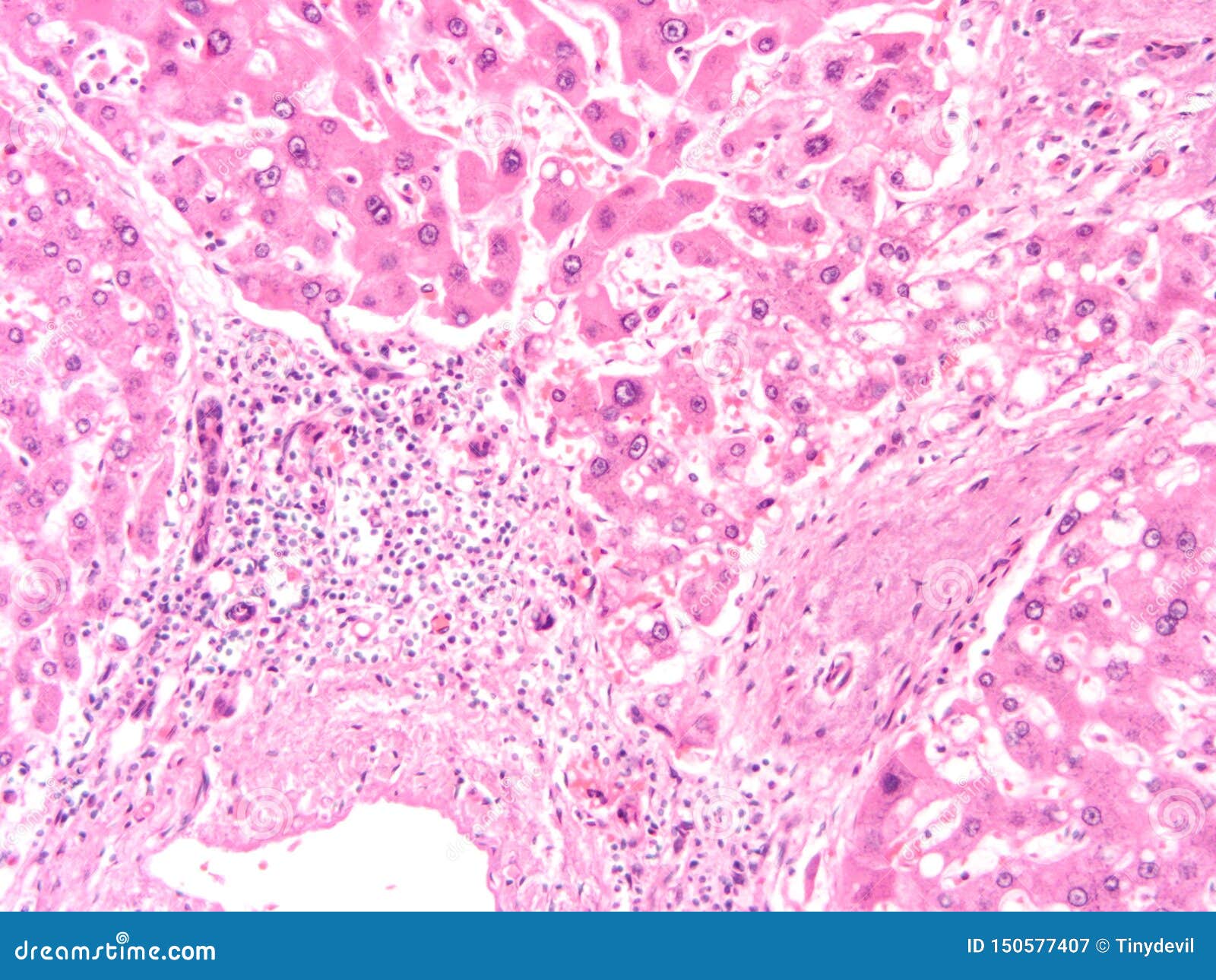 Histology of Human Liver Tissue Stock Image - Image of science, larynx ...