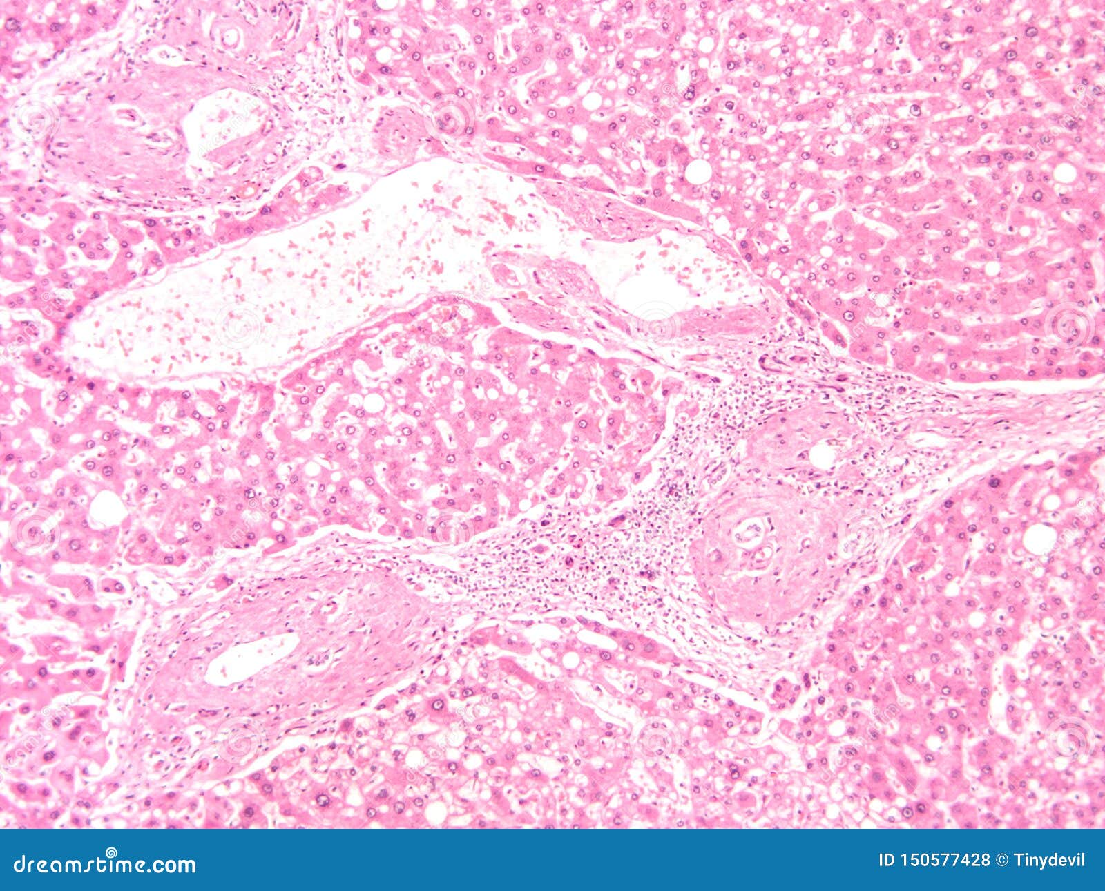 Histology of Human Liver Tissue Stock Photo - Image of physiology ...