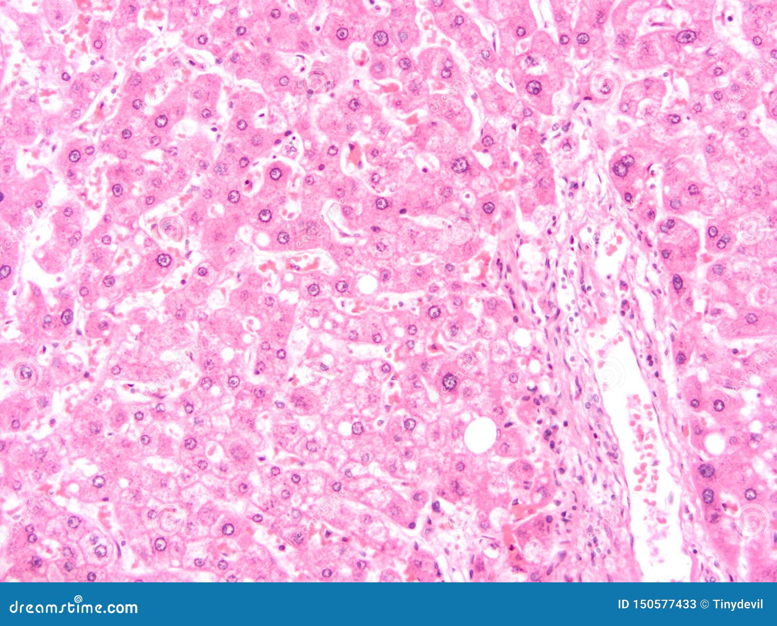 Histology of Human Liver Tissue Stock Image - Image of physiology ...
