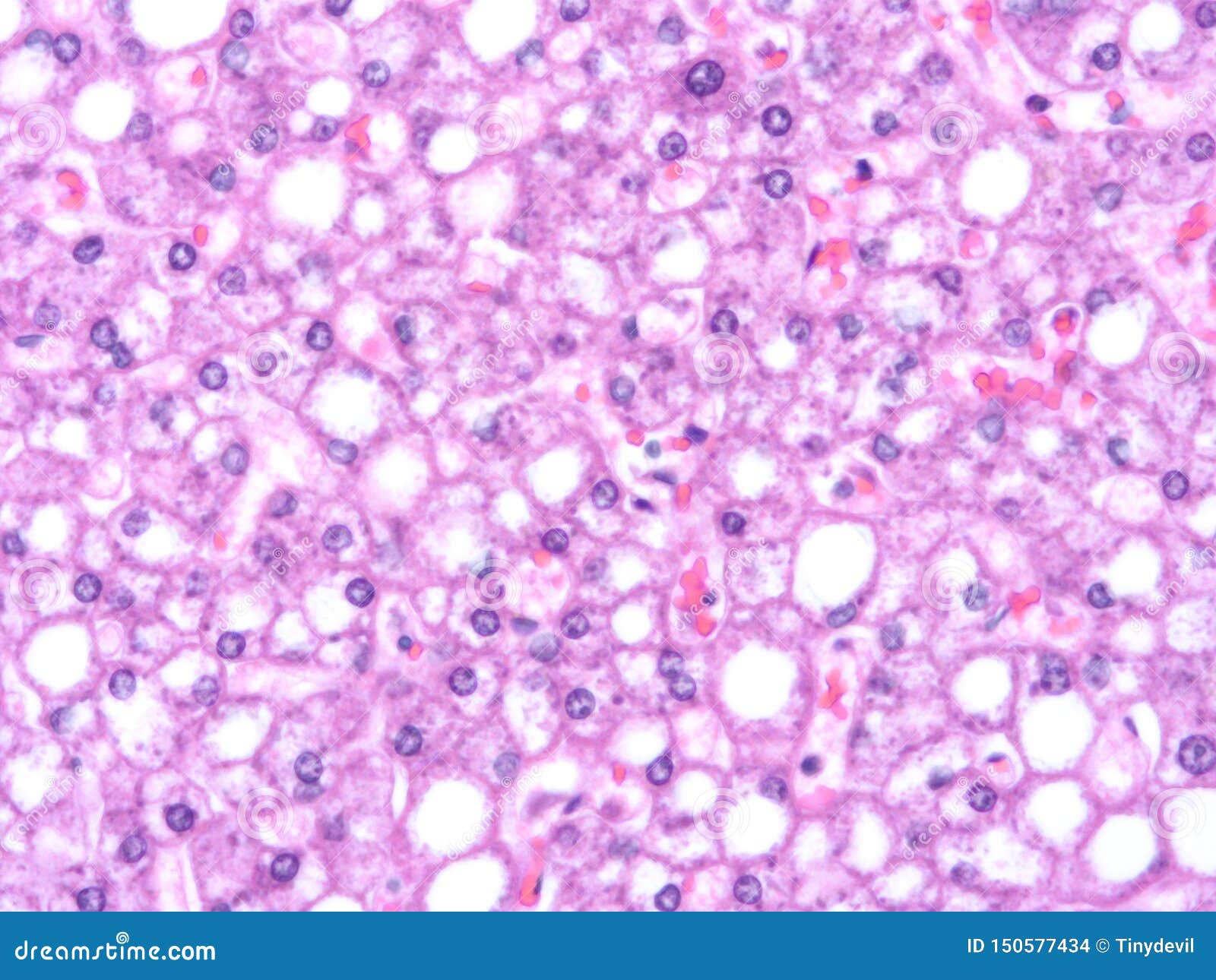 Histology of Human Liver Tissue Stock Photo - Image of study, histology ...