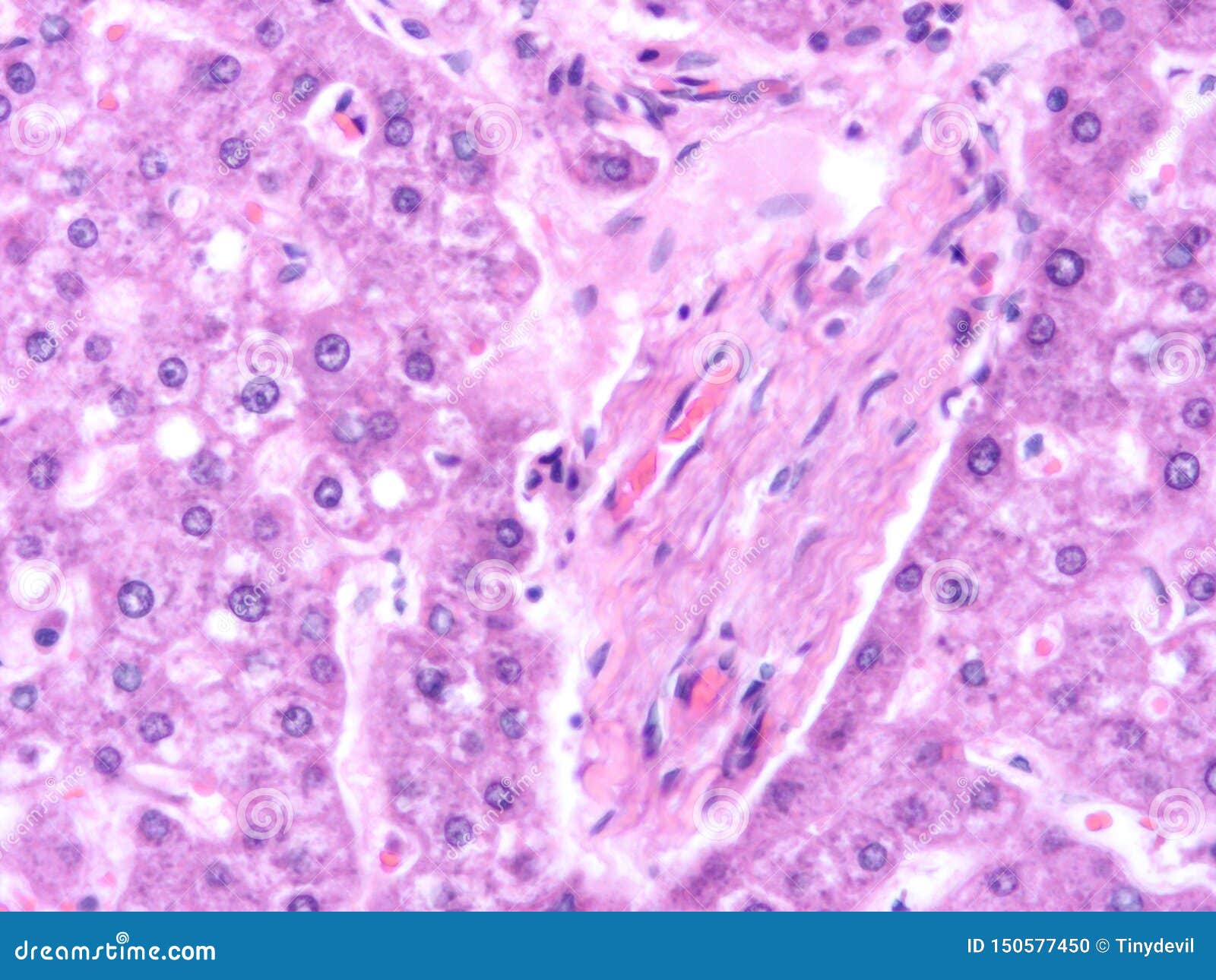 Histology of Human Liver Tissue Stock Photo - Image of tissue, doctor ...