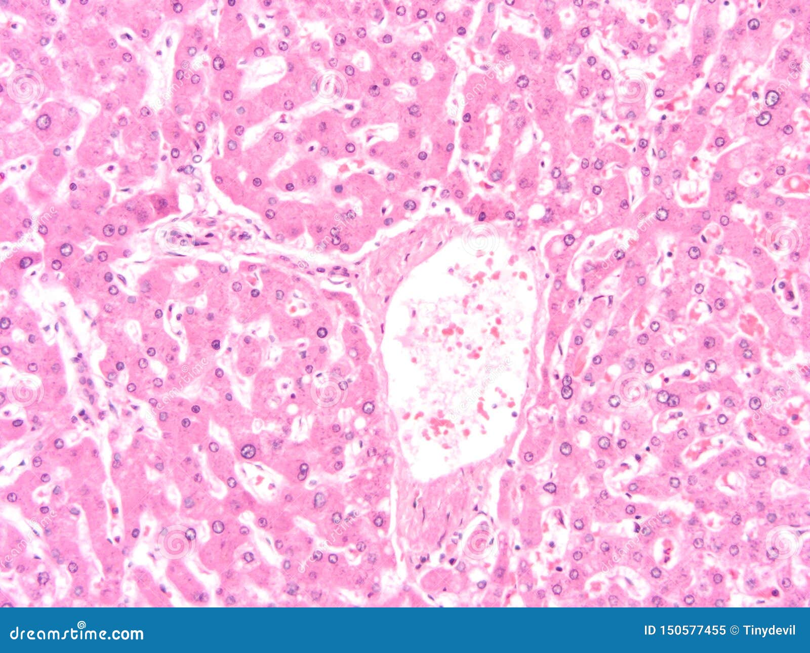 Liver Tissue Histology at Tyson Macgillivray blog