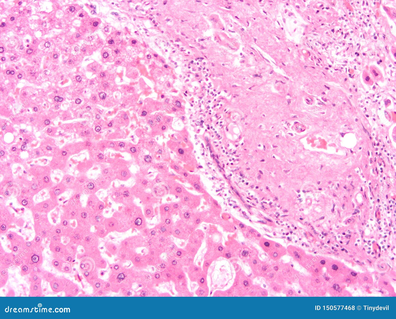 Histology of Human Liver Tissue Stock Photo - Image of doctor, human ...