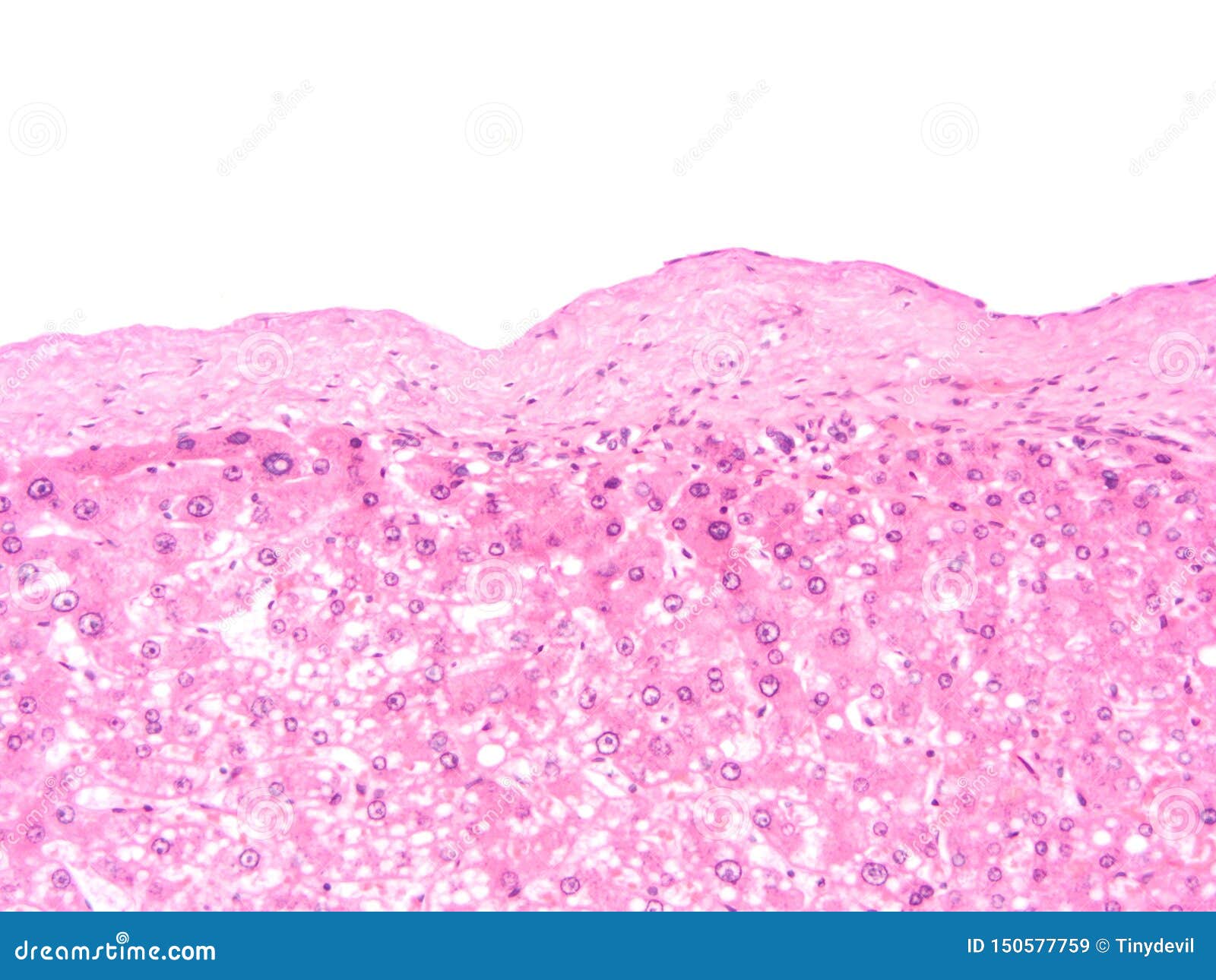 Histology of Human Liver Tissue Stock Image - Image of view, tendon ...