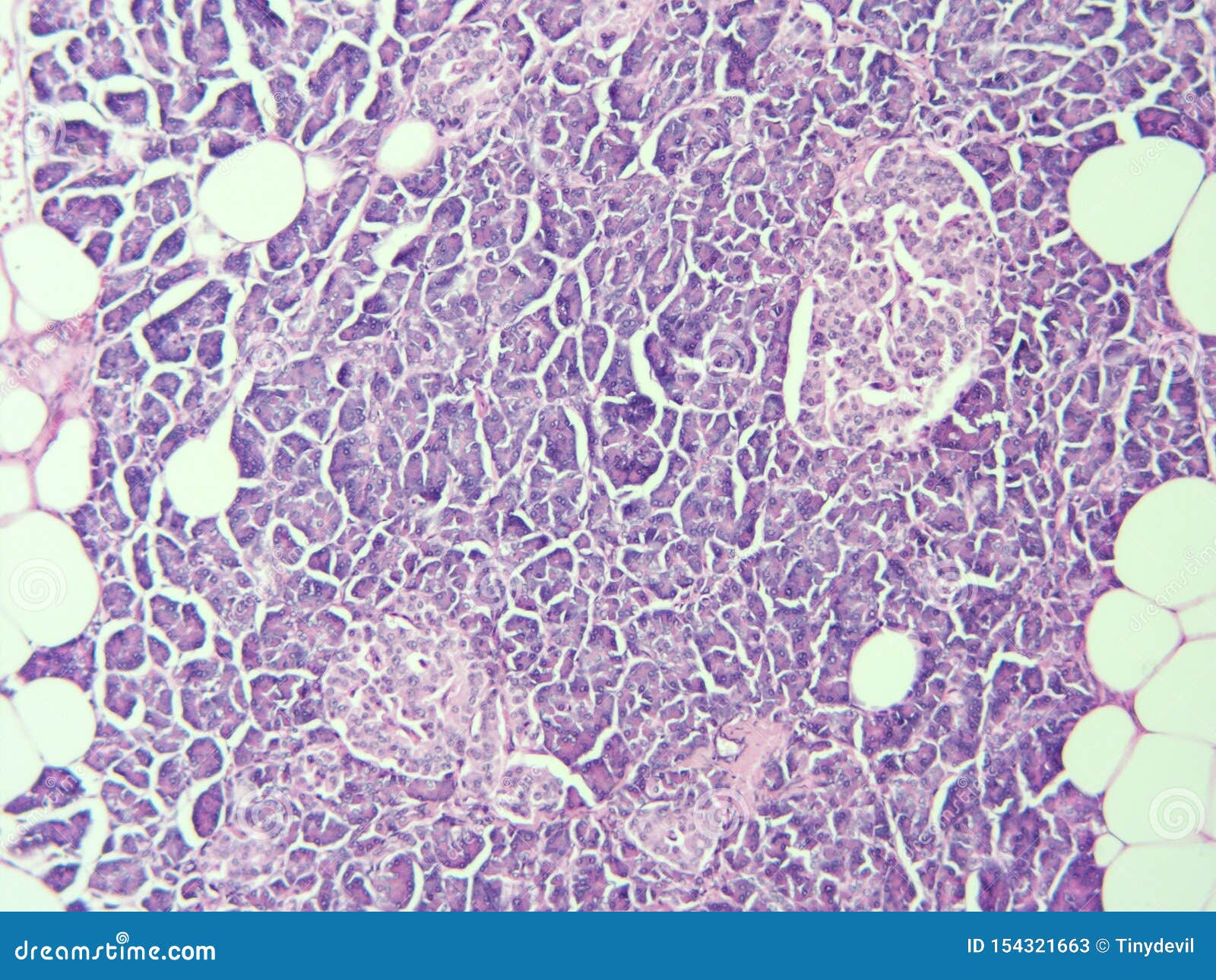 Histology of Human Pancreas Tissue Stock Image - Image of adipose ...