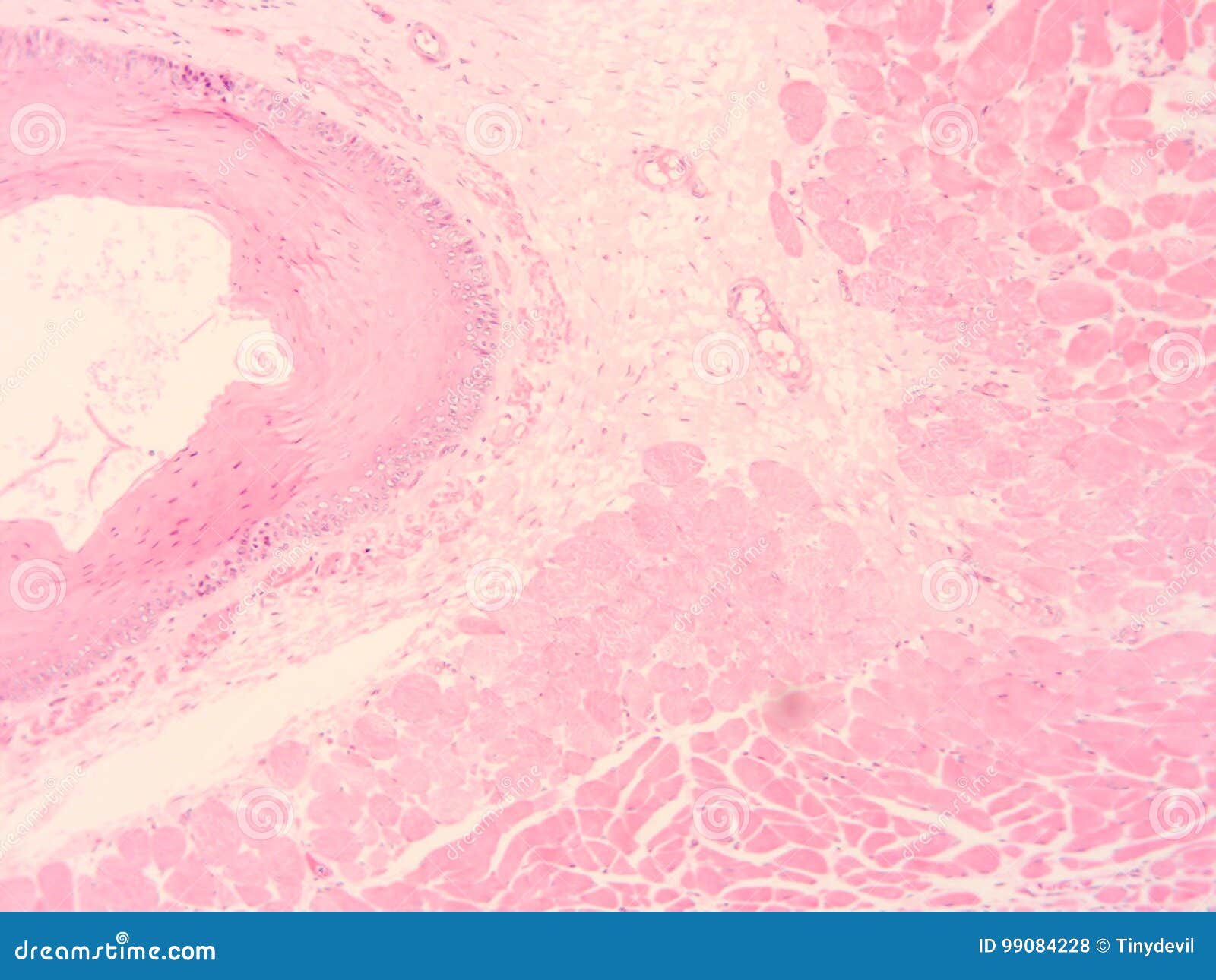Histology of human tissue stock photo. Image of health - 99084228