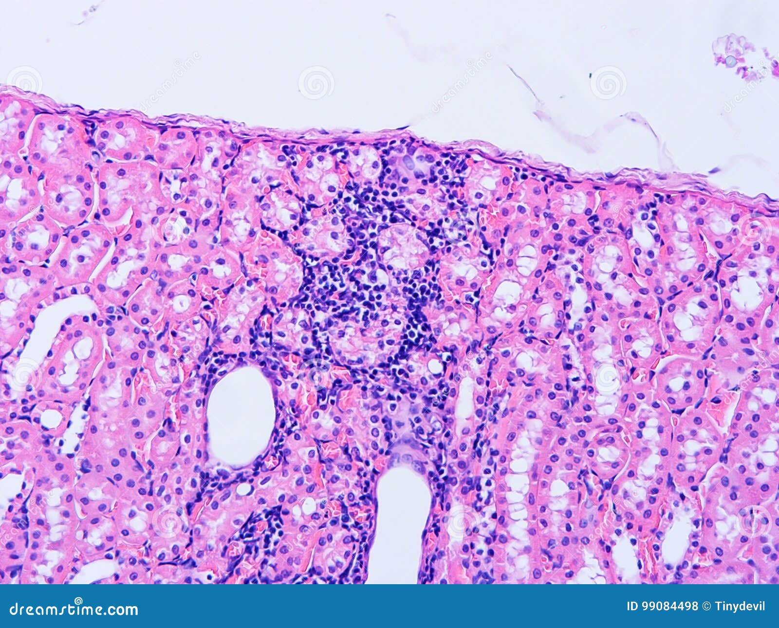 Histology of human tissue stock photo. Image of microscopic - 99084498