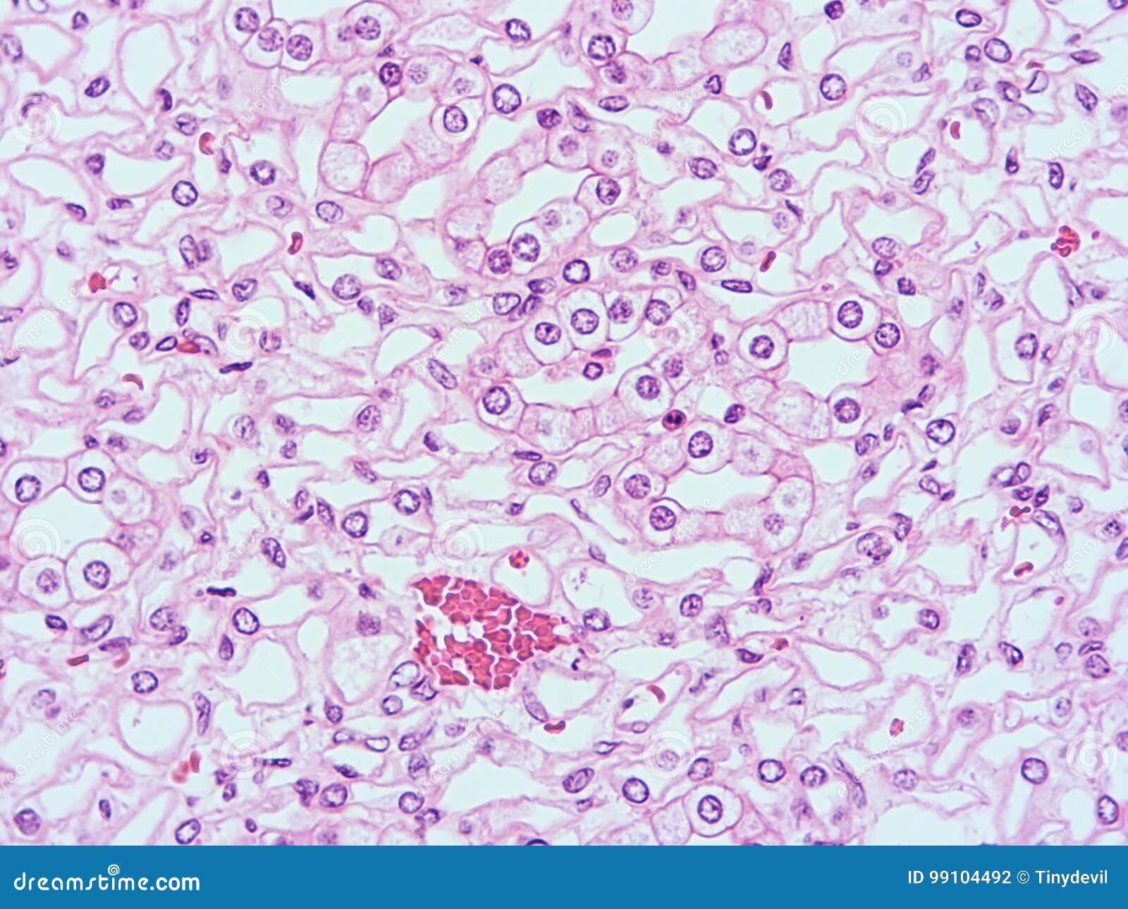 Histology of human tissue stock photo. Image of pathology - 99104492