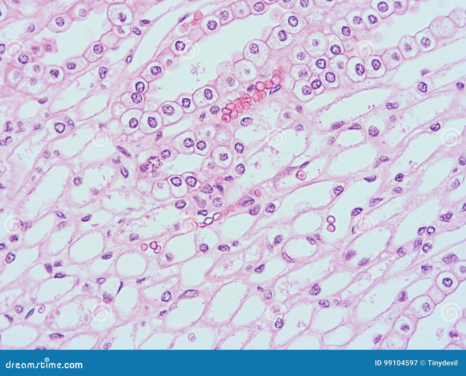 Histology of human tissue stock image. Image of study - 99104597