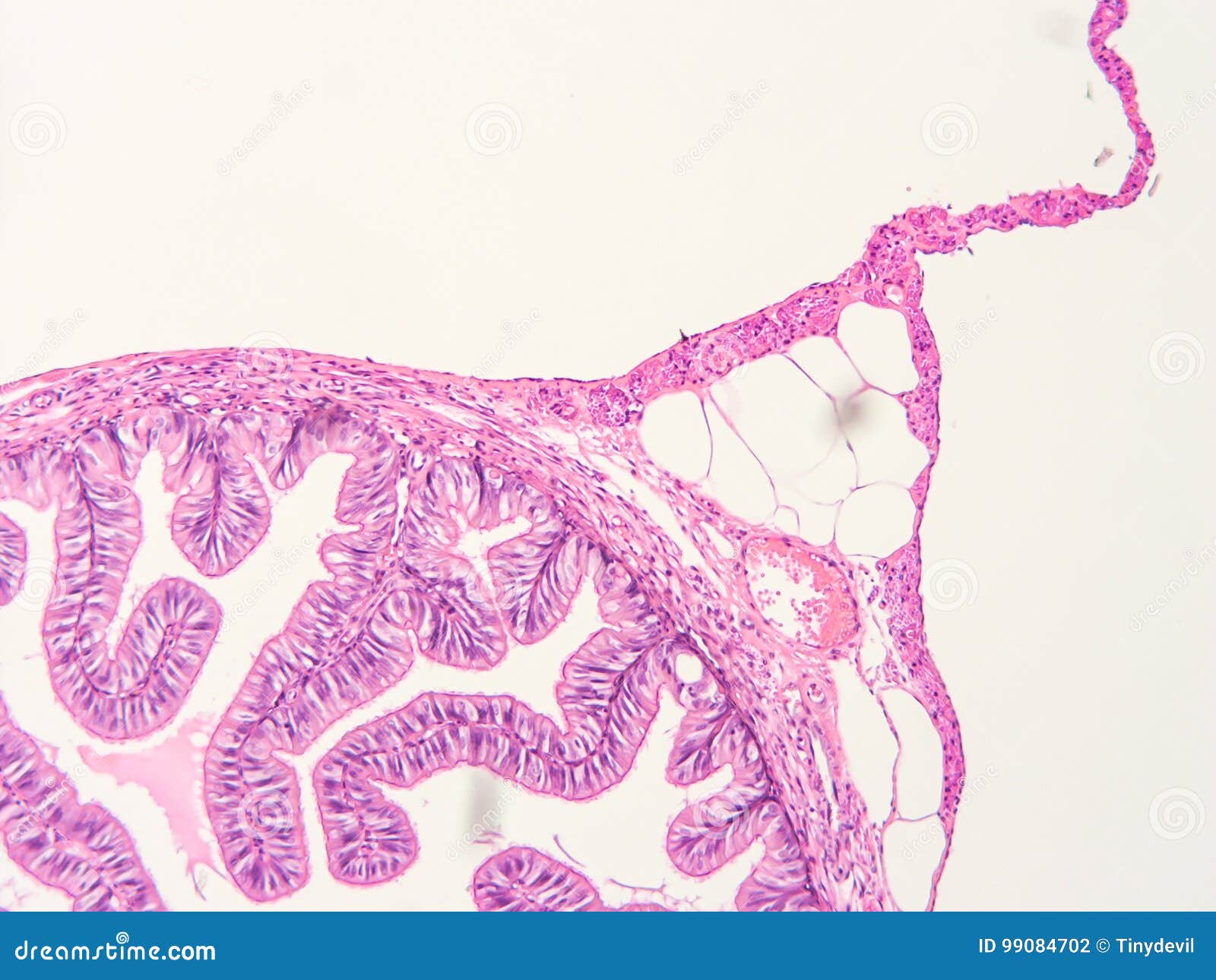 Histology of human tissue stock photo. Image of science - 99084702