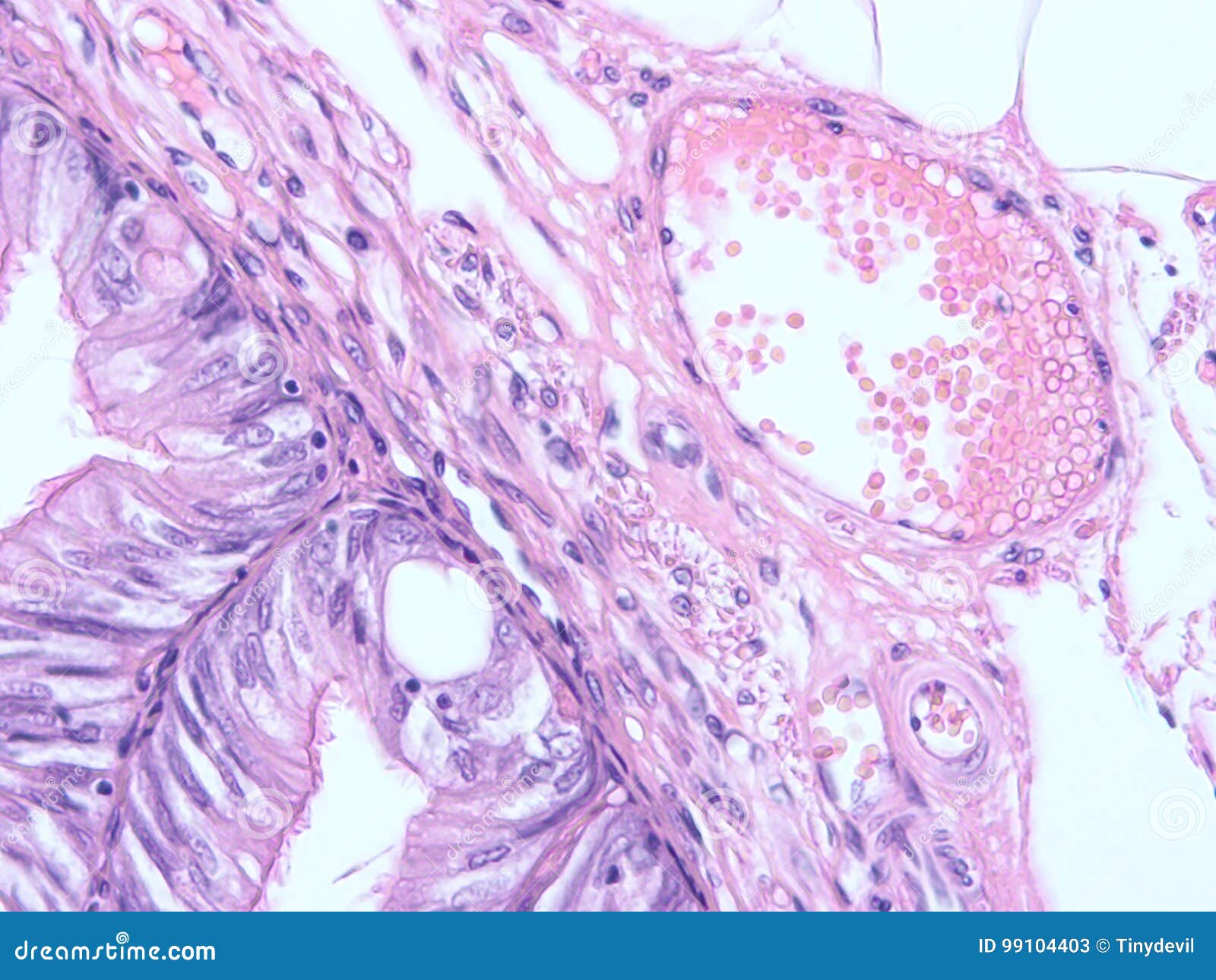 Histology of human tissue stock image. Image of connective - 99104403