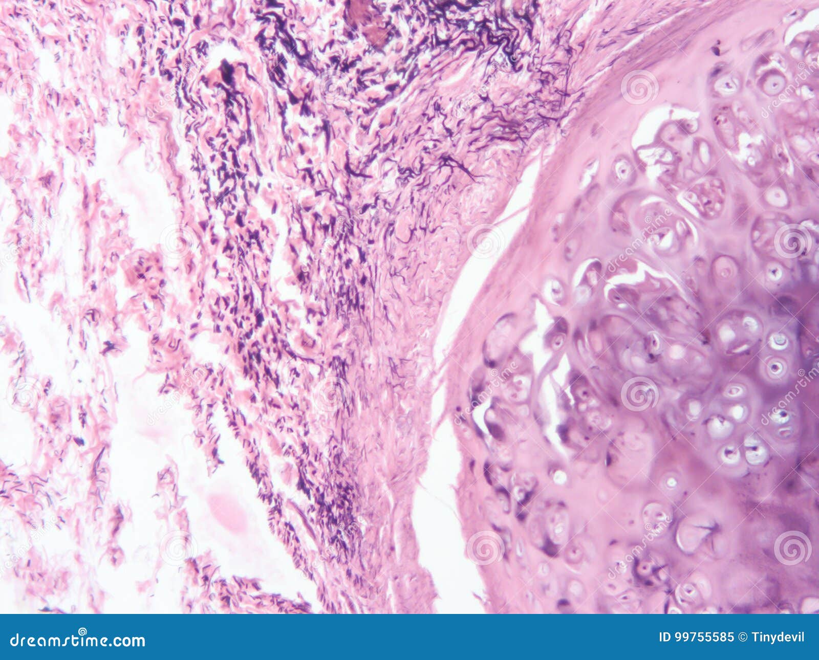 Histology of Cartilage Human Tissue Stock Image - Image of squamous ...