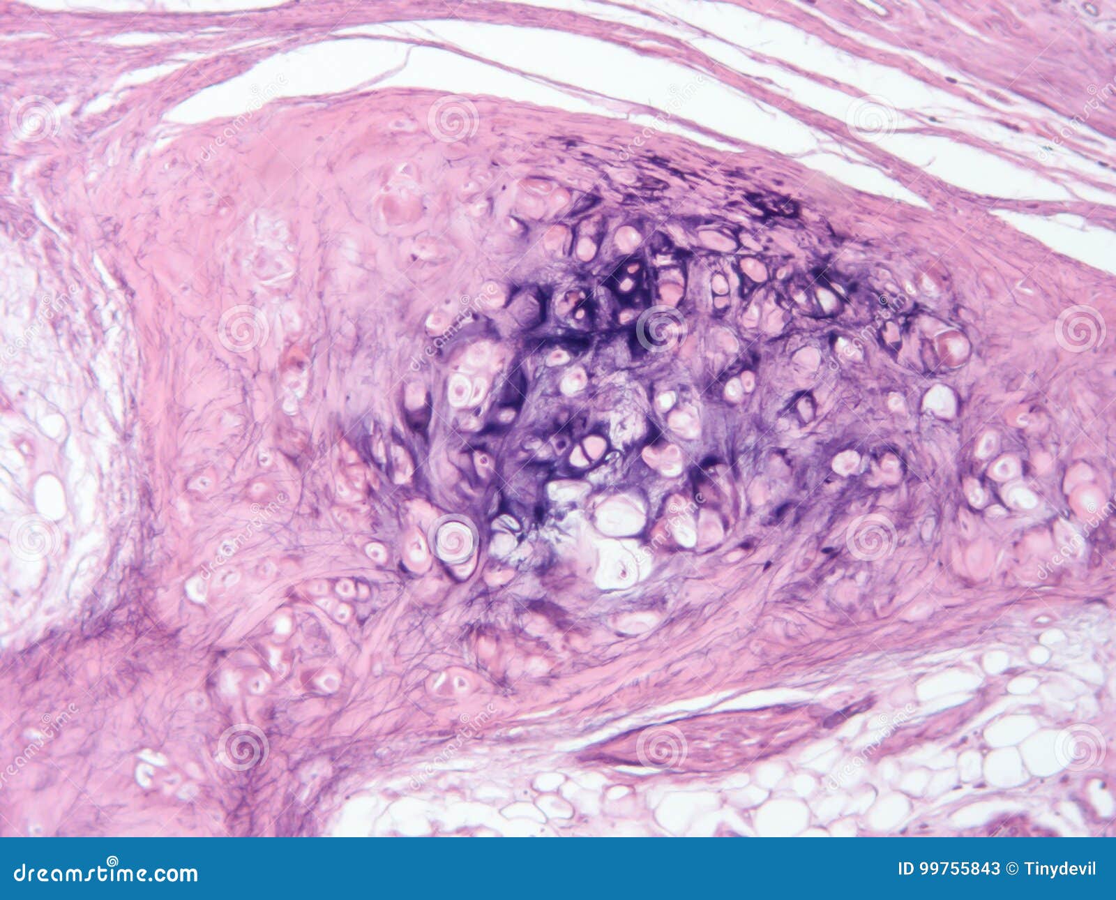 Histology of Cartilage Human Tissue Stock Image - Image of microscopy ...