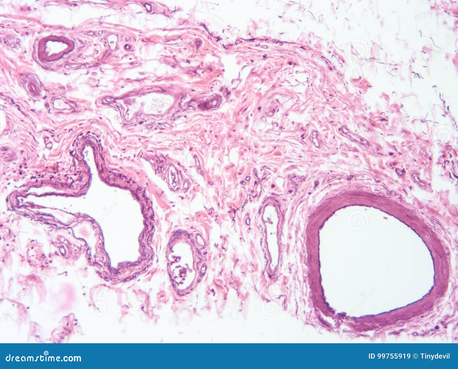 Histology of Cartilage Human Tissue Stock Image - Image of squamous ...