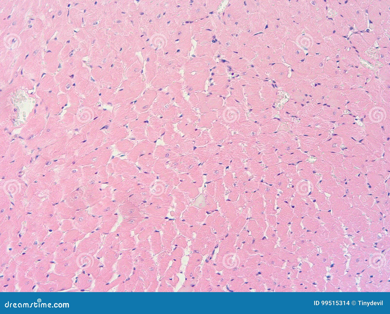 Histology of Heart Human Tissue Stock Photo - Image of muscle, heart ...