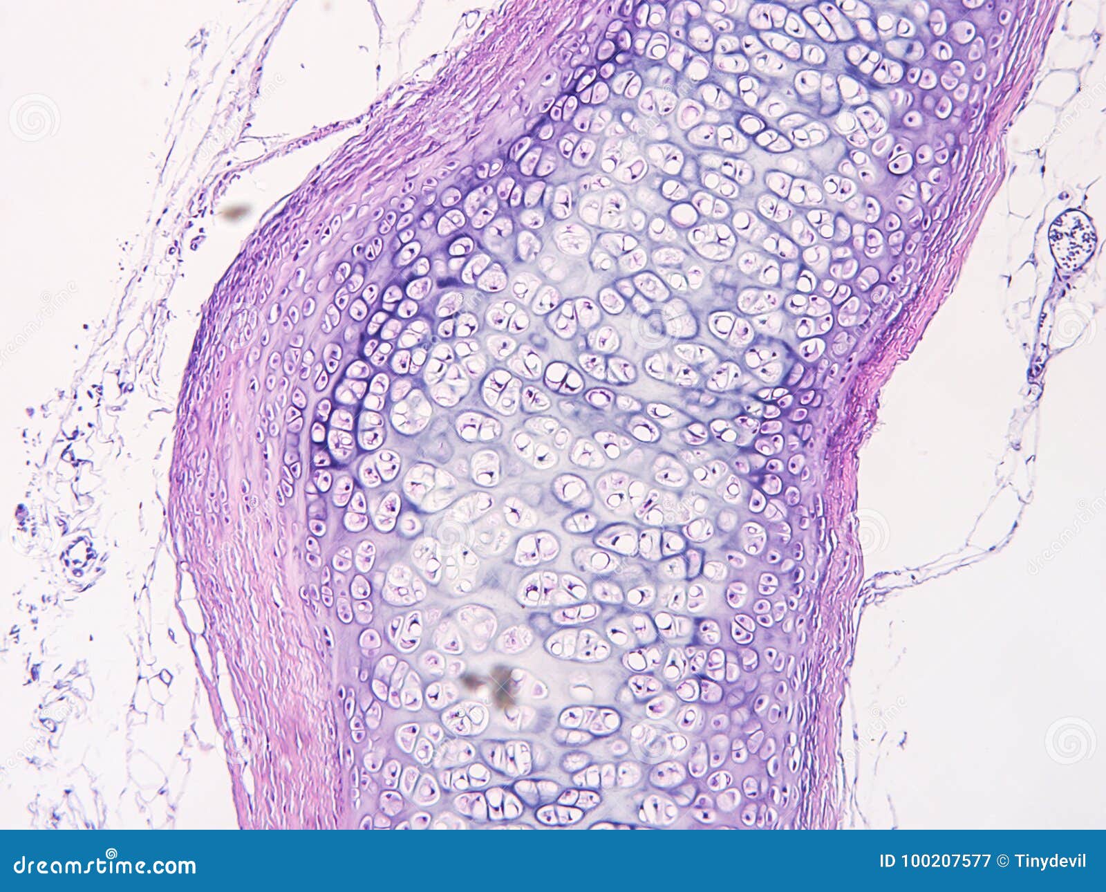Histology Of Human Compact Bone Tissue Under Microscope View For Stock ...
