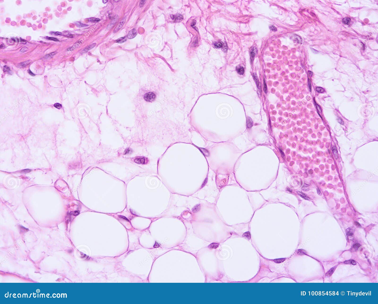 Histology of human tissue stock photo. Image of pathology - 100854584