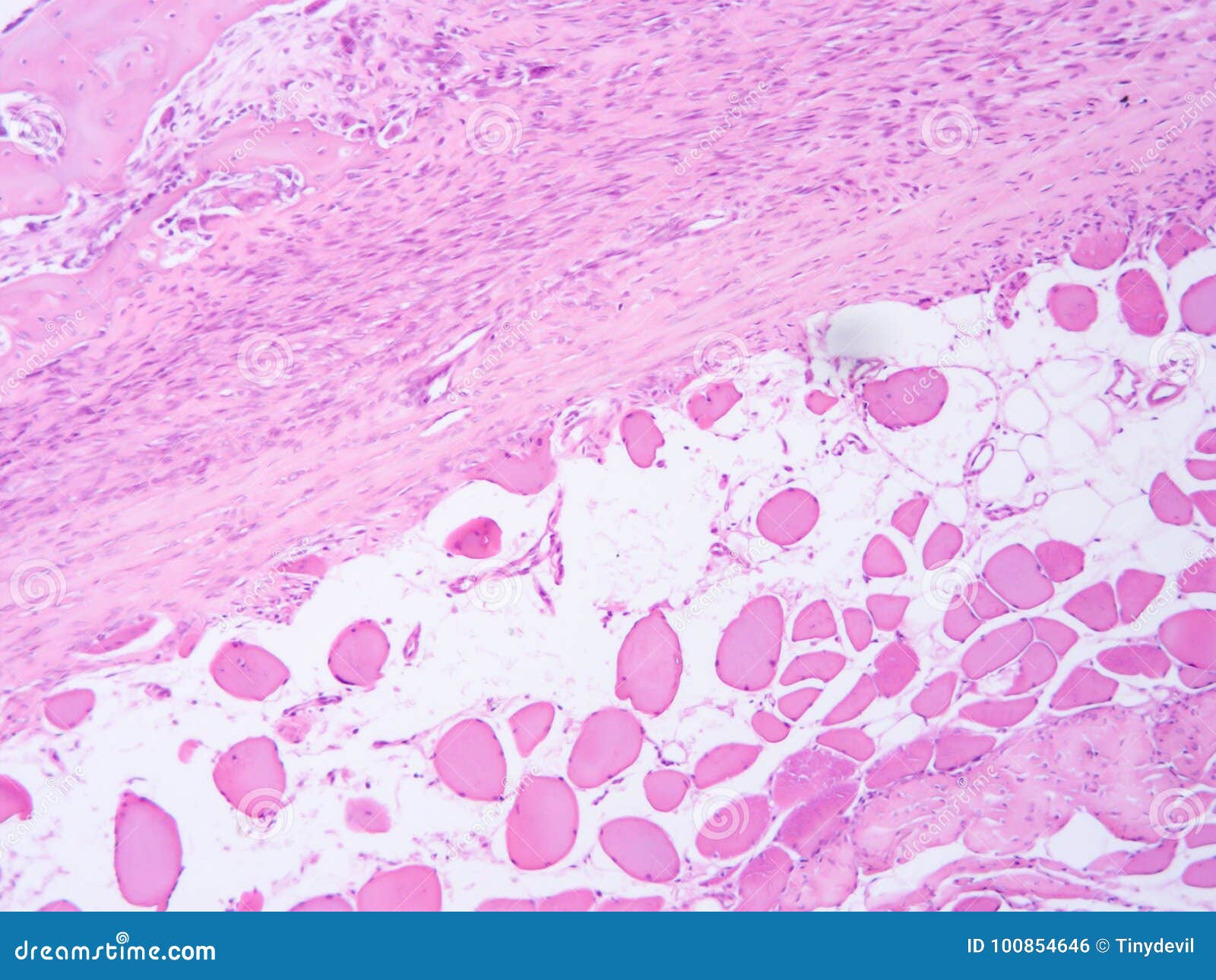 Histology of human tissue stock photo. Image of histology - 100854646