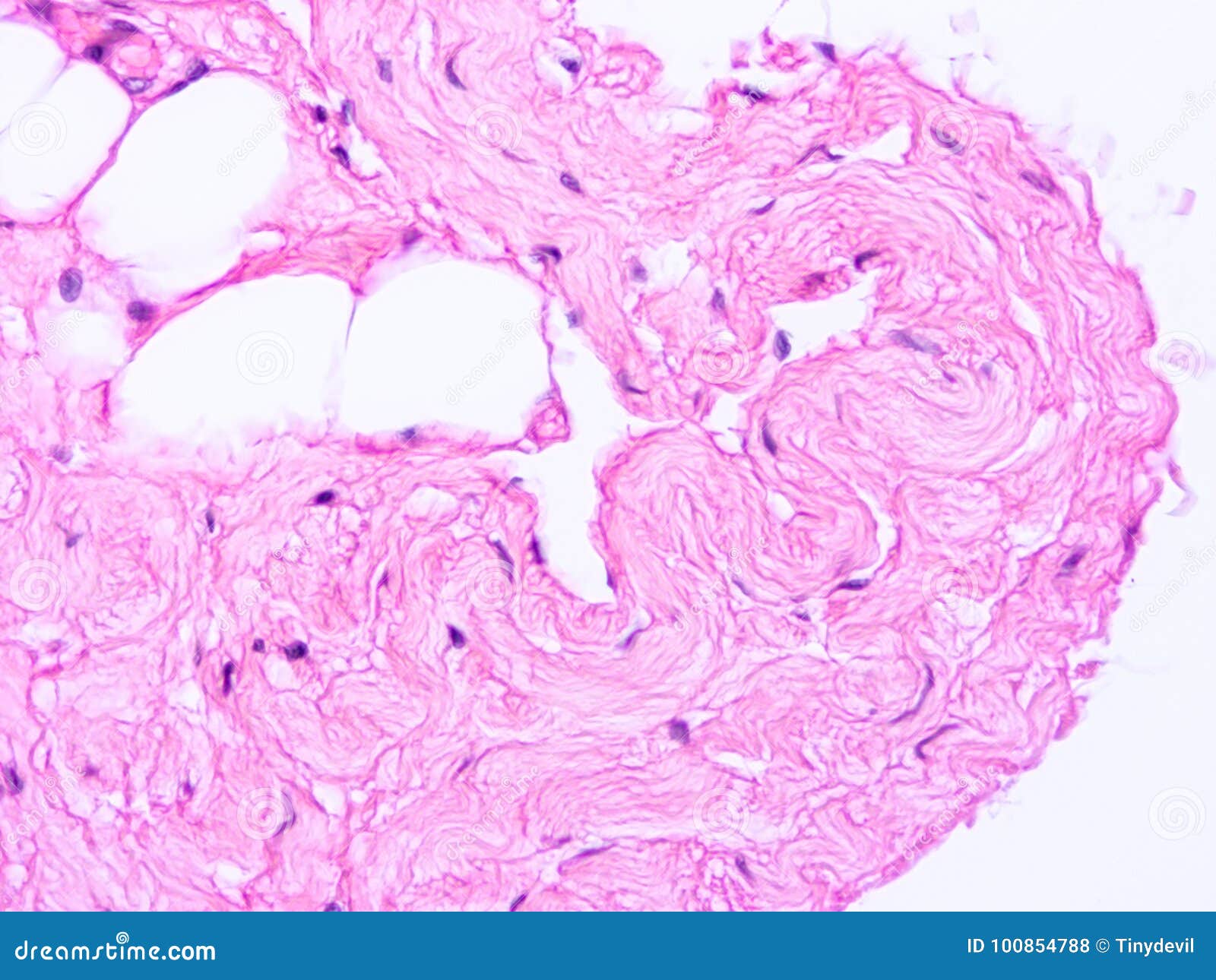 Histology of human tissue stock photo. Image of tendon - 100854788