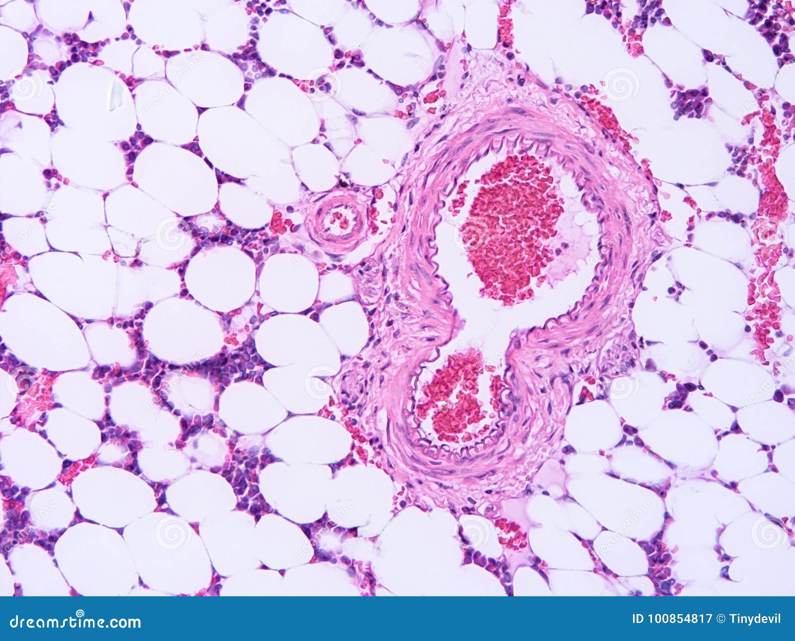 Histology of human tissue stock image. Image of human - 100854817