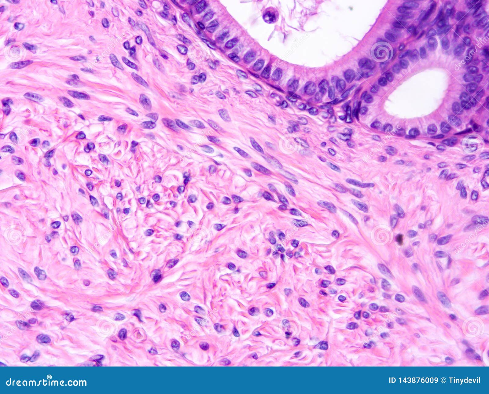 Histology of human tissue stock image. Image of connective - 143876009