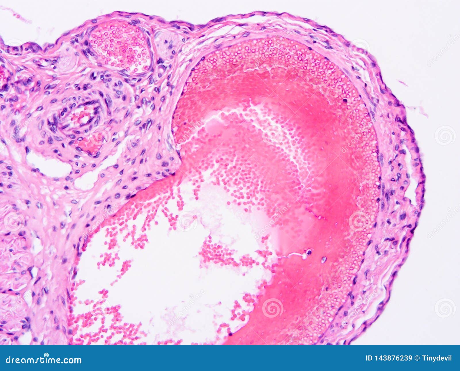 Histology of human tissue stock image. Image of research - 143876239
