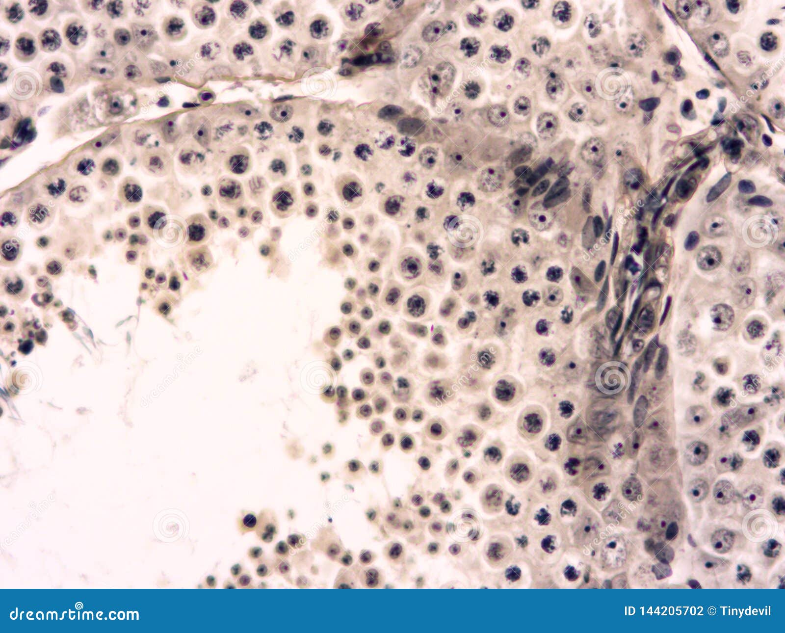 Histology Of Human Compact Bone Tissue Under Microscope View For ...