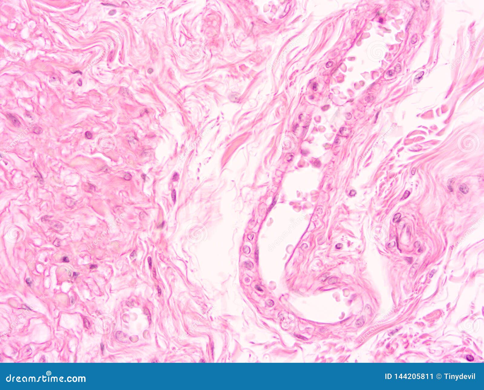 Histology Of Human Compact Bone Tissue Under Microscope View For ...