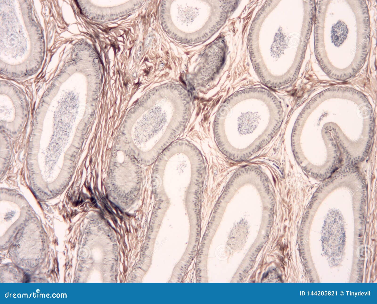 Histology Of Human Compact Bone Tissue Under Microscope View For ...