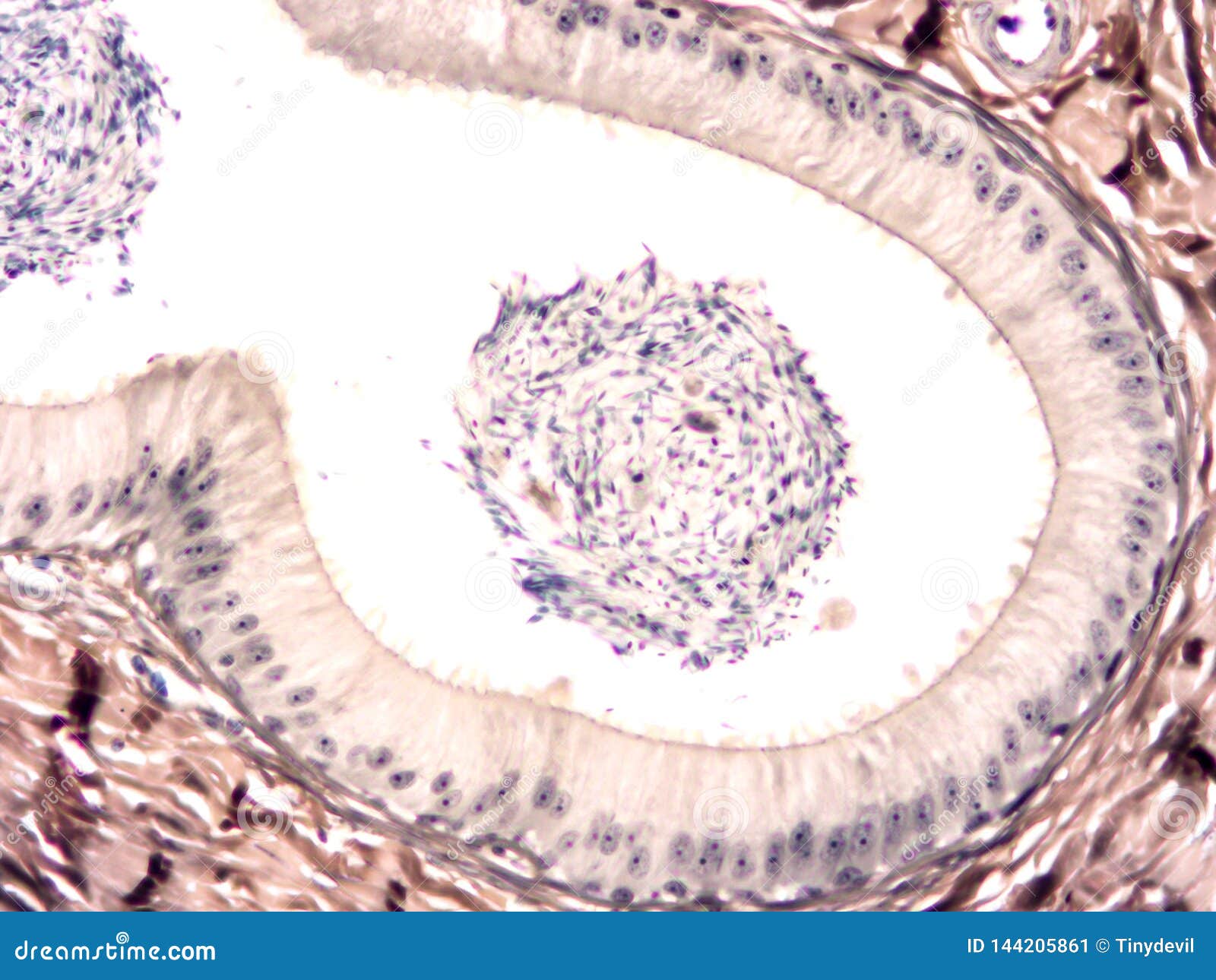 Histology Of Human Compact Bone Tissue Under Microscope View For Stock ...