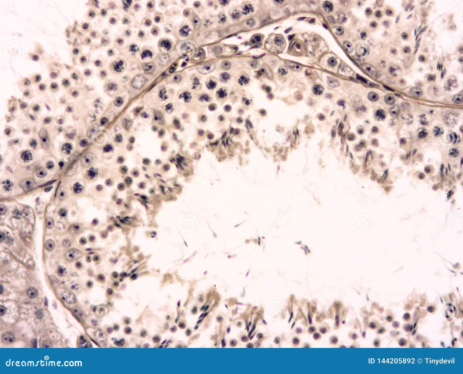 Histology Of Human Compact Bone Tissue Under Microscope View For ...