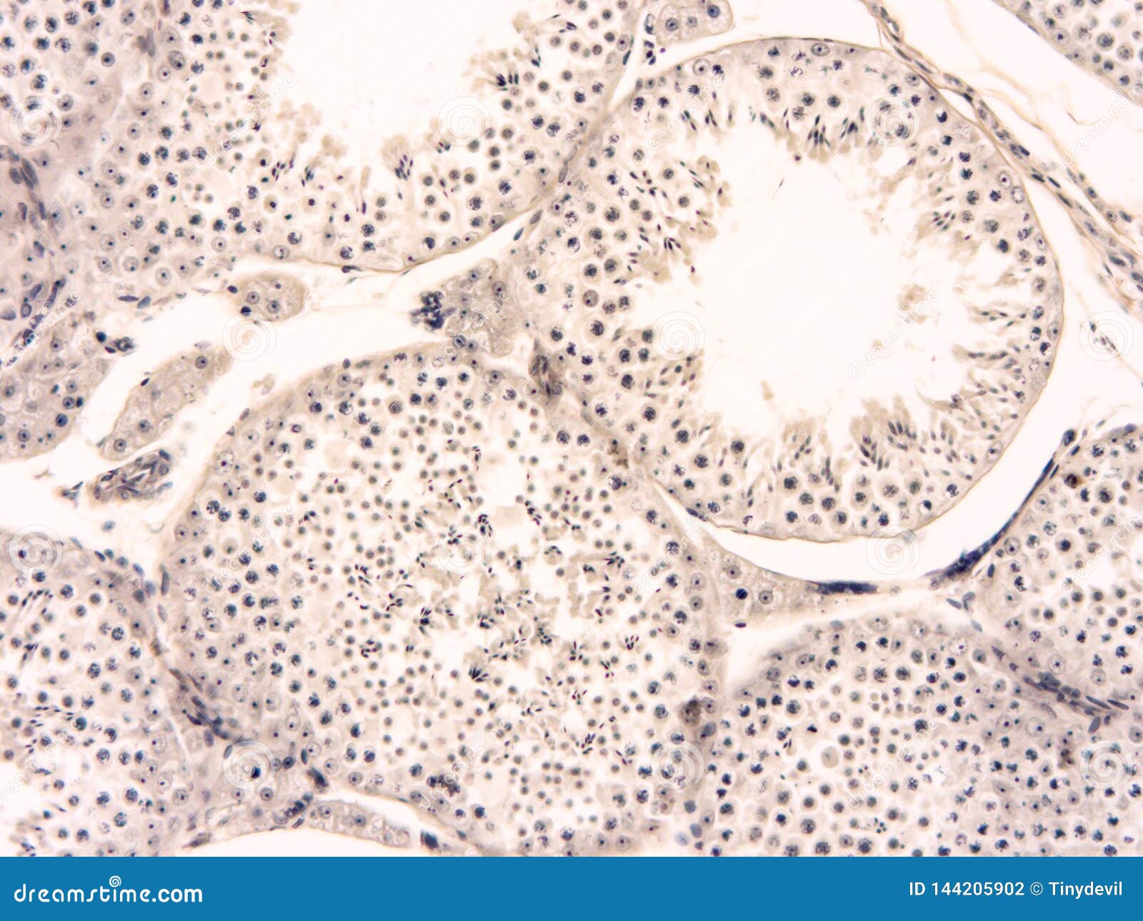 Histology Of Human Compact Bone Tissue Under Microscope View For ...