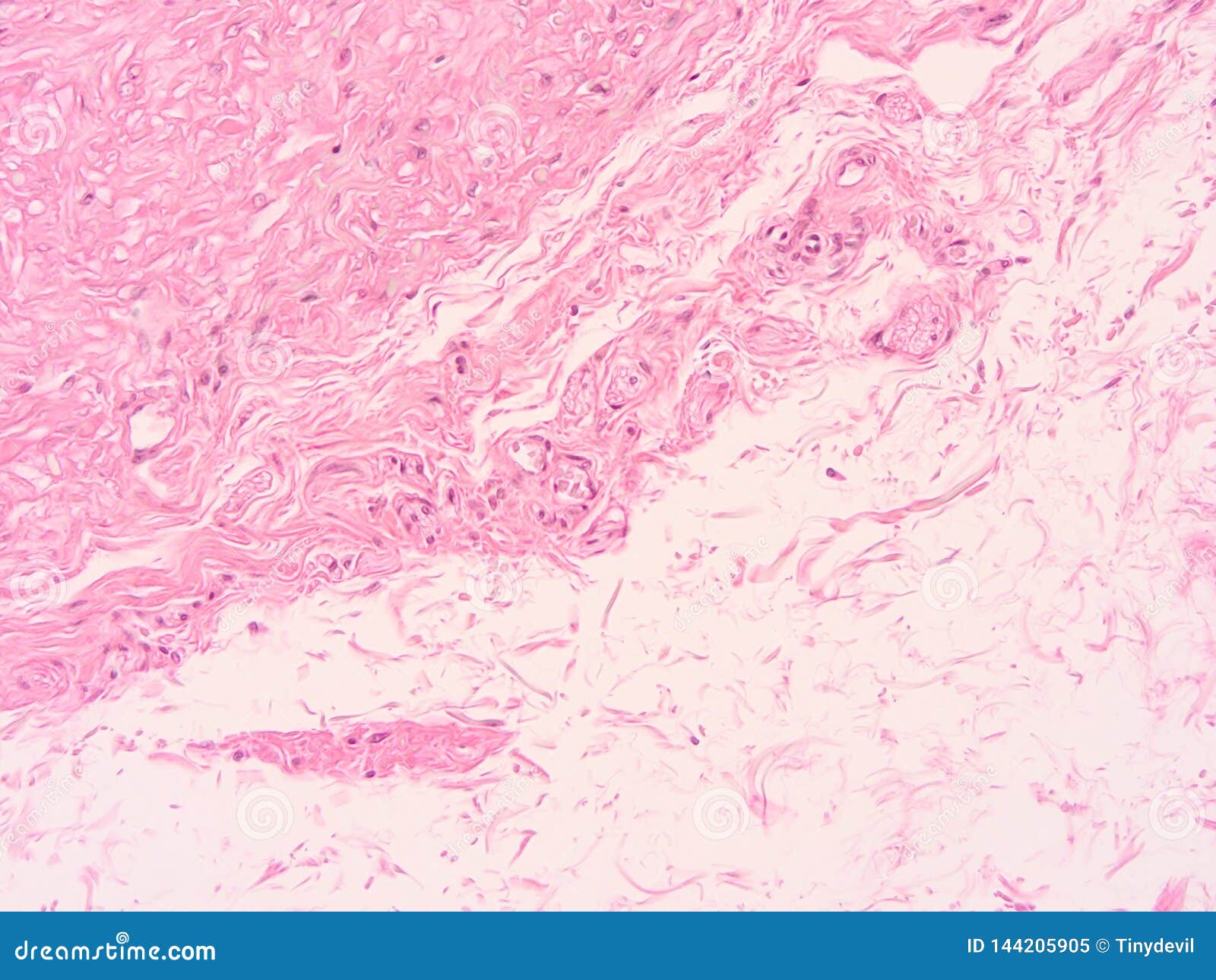 Histology of human tissue stock image. Image of cell - 144205905