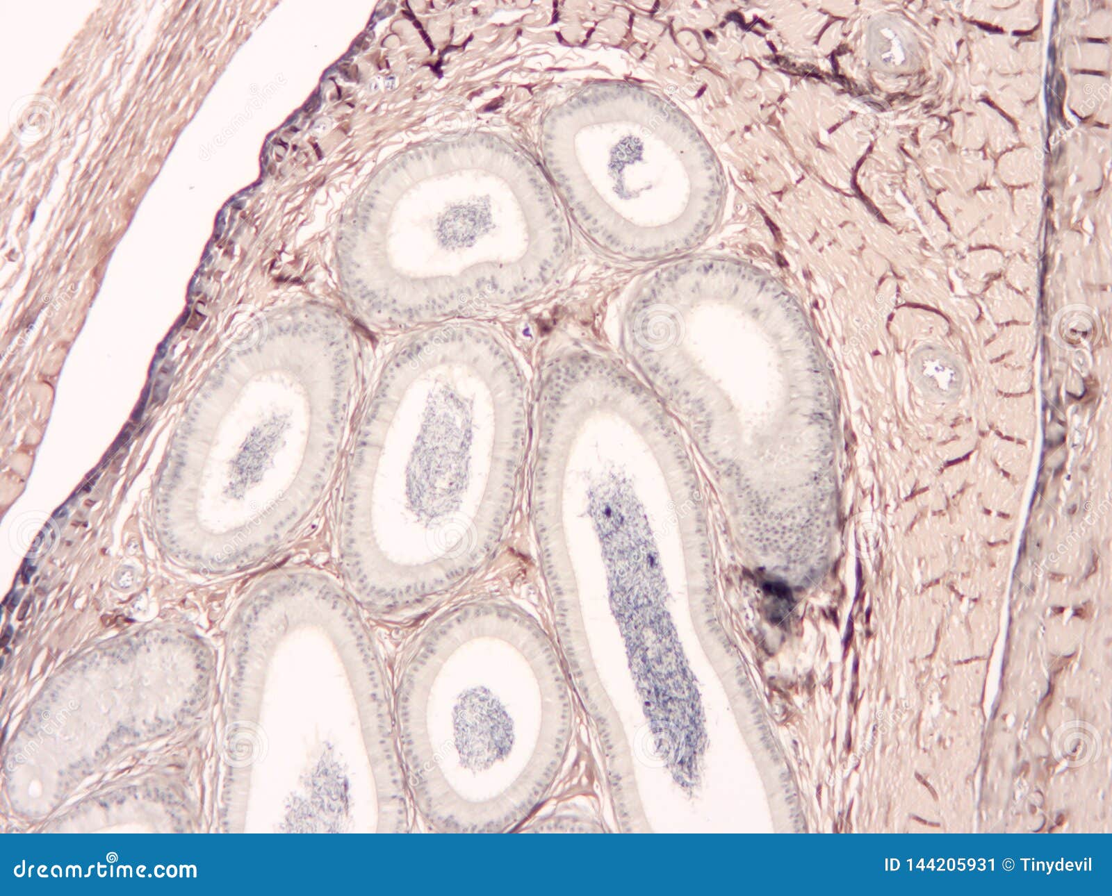 Histology Of Human Compact Bone Tissue Under Microscope View For ...
