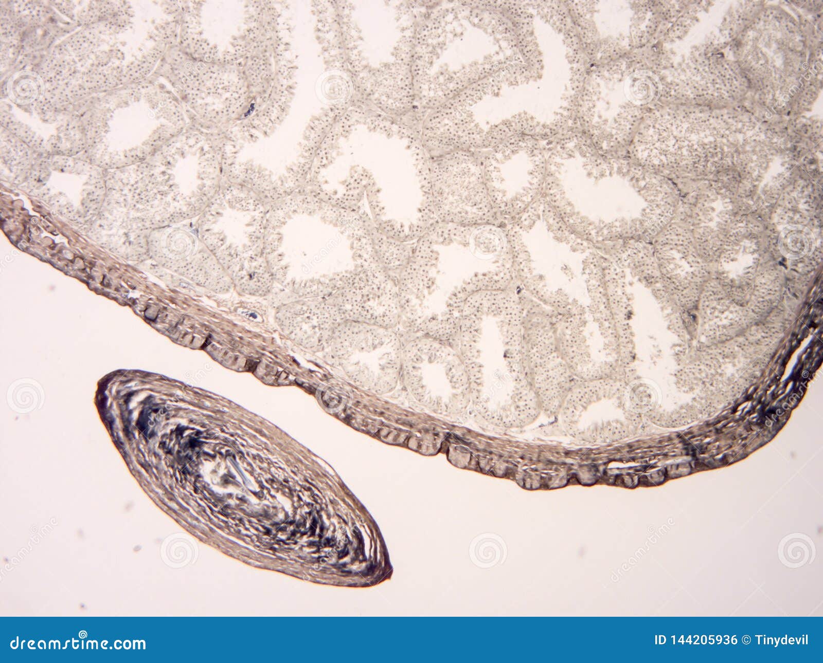 Histology of human tissue stock photo. Image of microscopy - 144205936