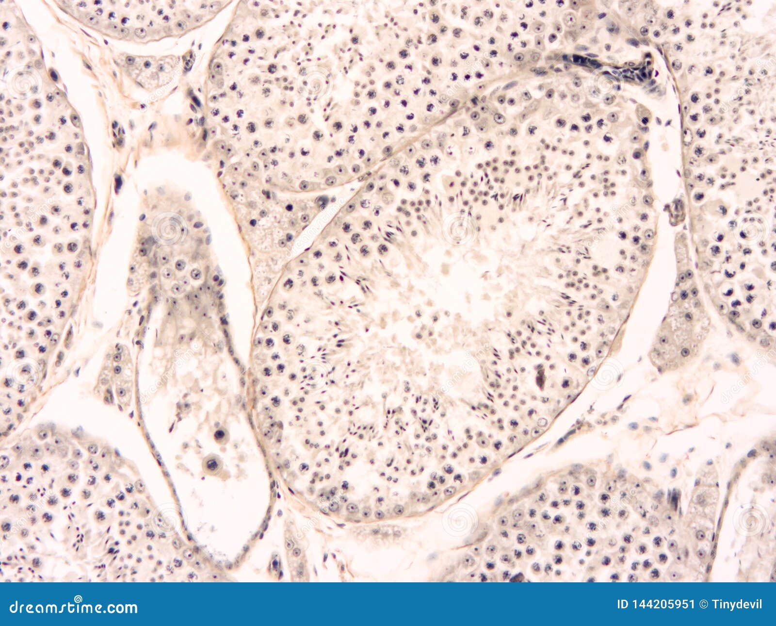 Histology Of Human Compact Bone Tissue Under Microscope View For ...