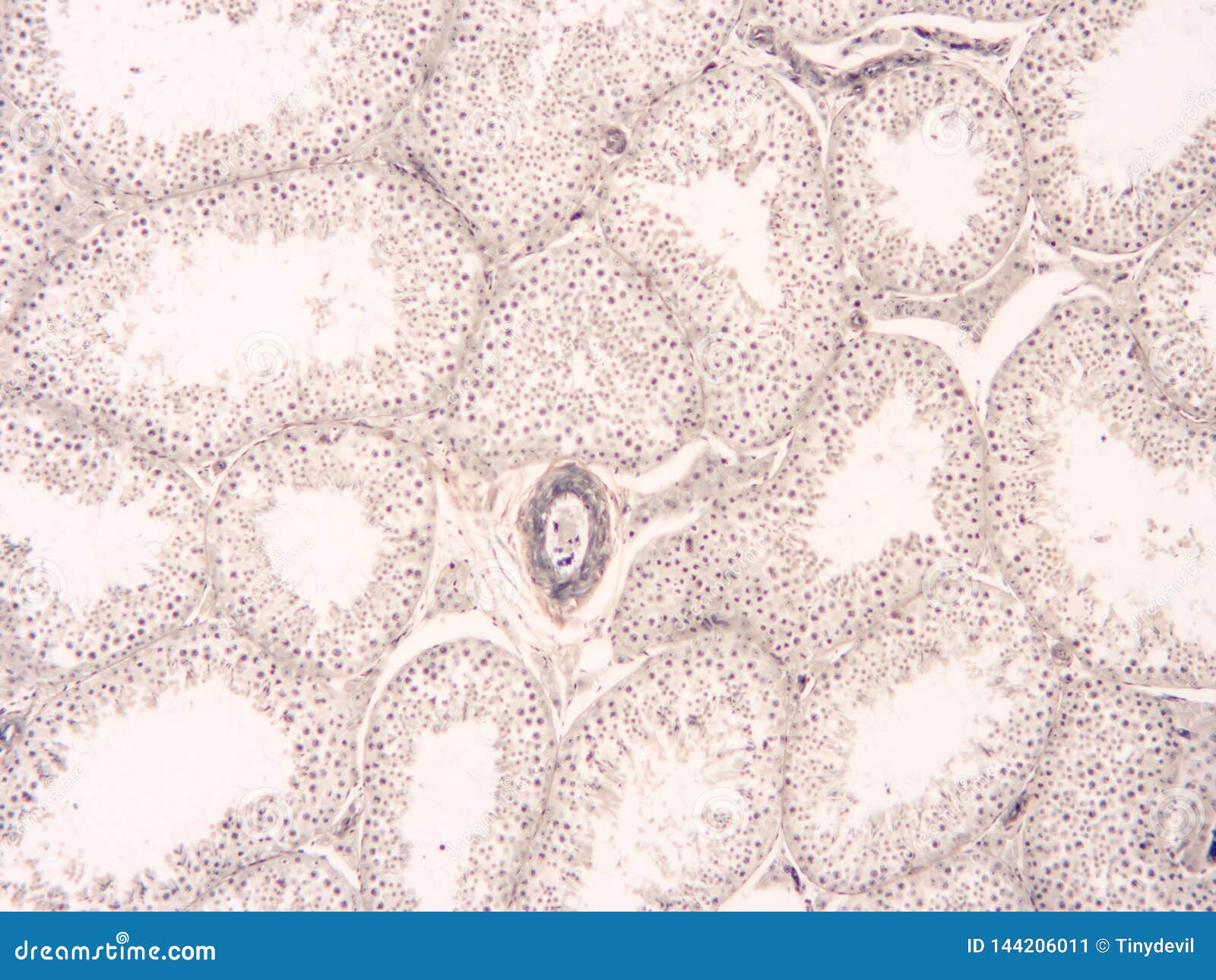 Histology Of Human Compact Bone Tissue Under Microscope View For ...