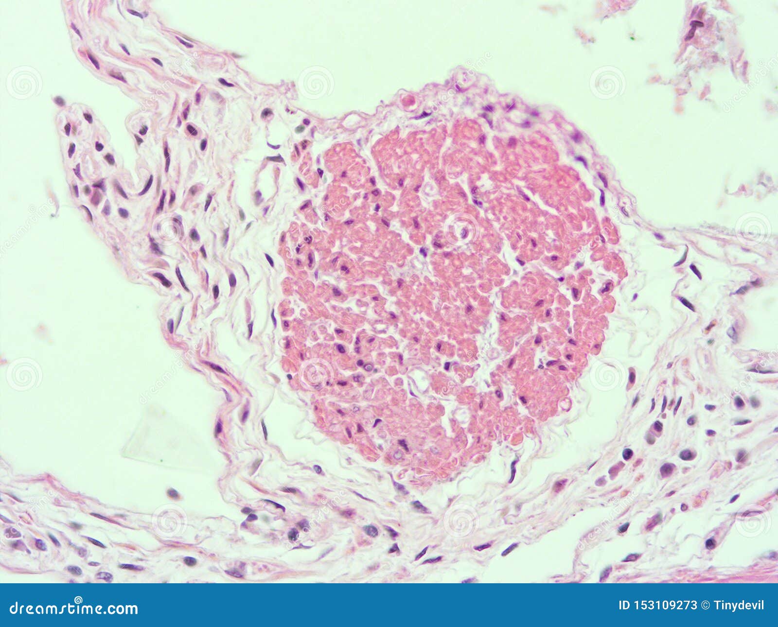 Histology of Human Gallbladder Tissue Stock Image - Image of microscope ...