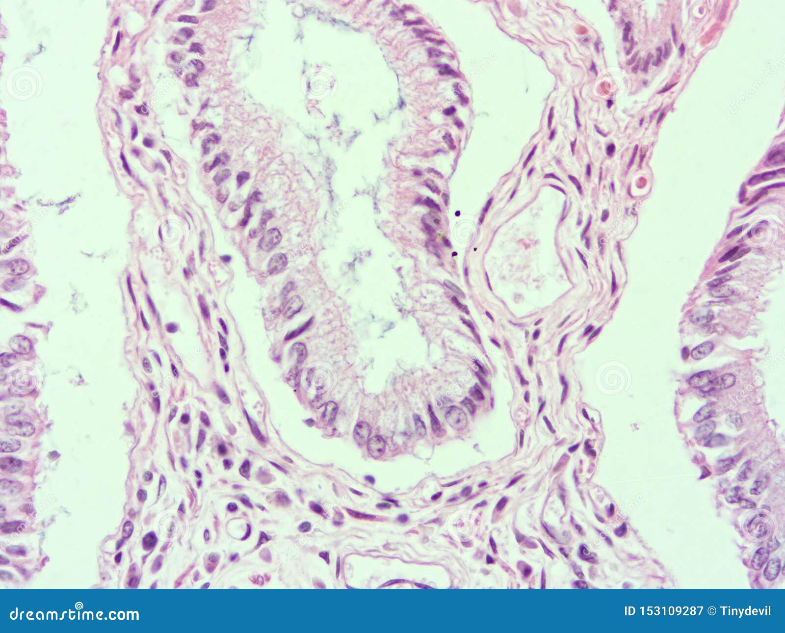 Histology of Human Gallbladder Tissue Stock Image - Image of ...