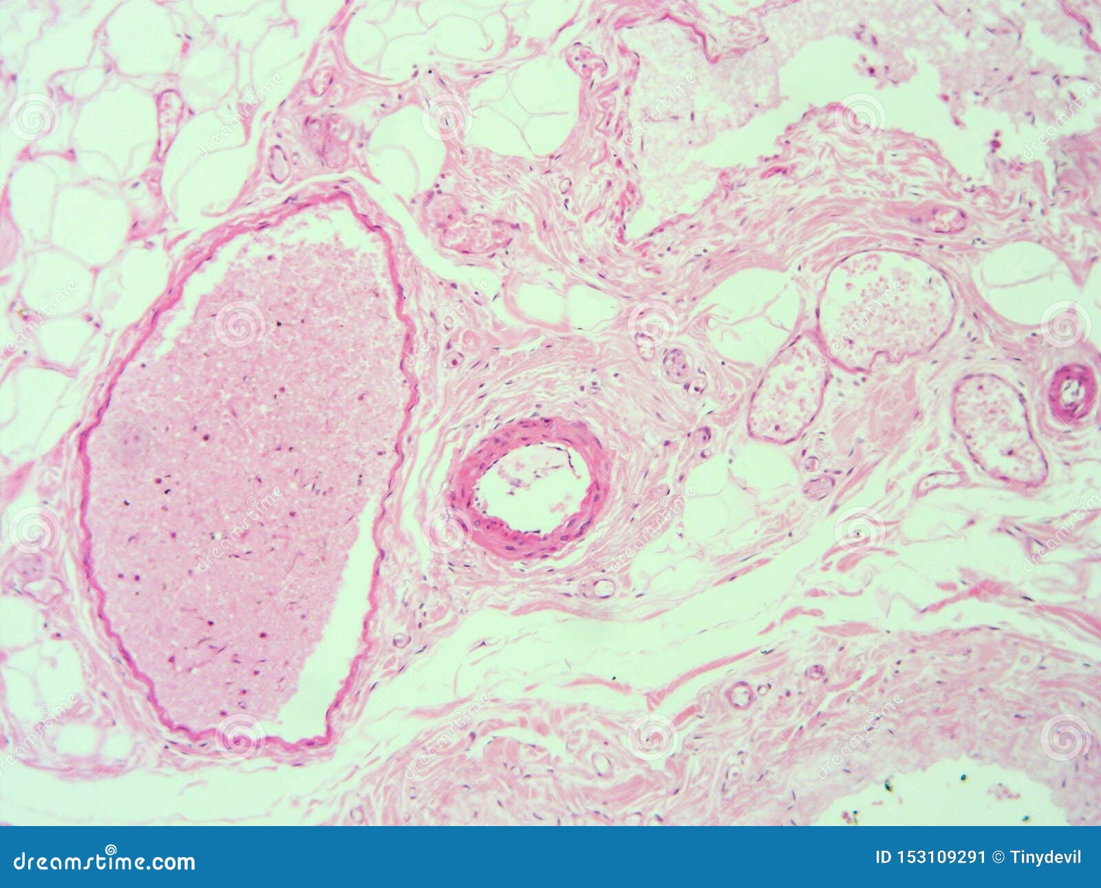 Microscopic Gallbladder