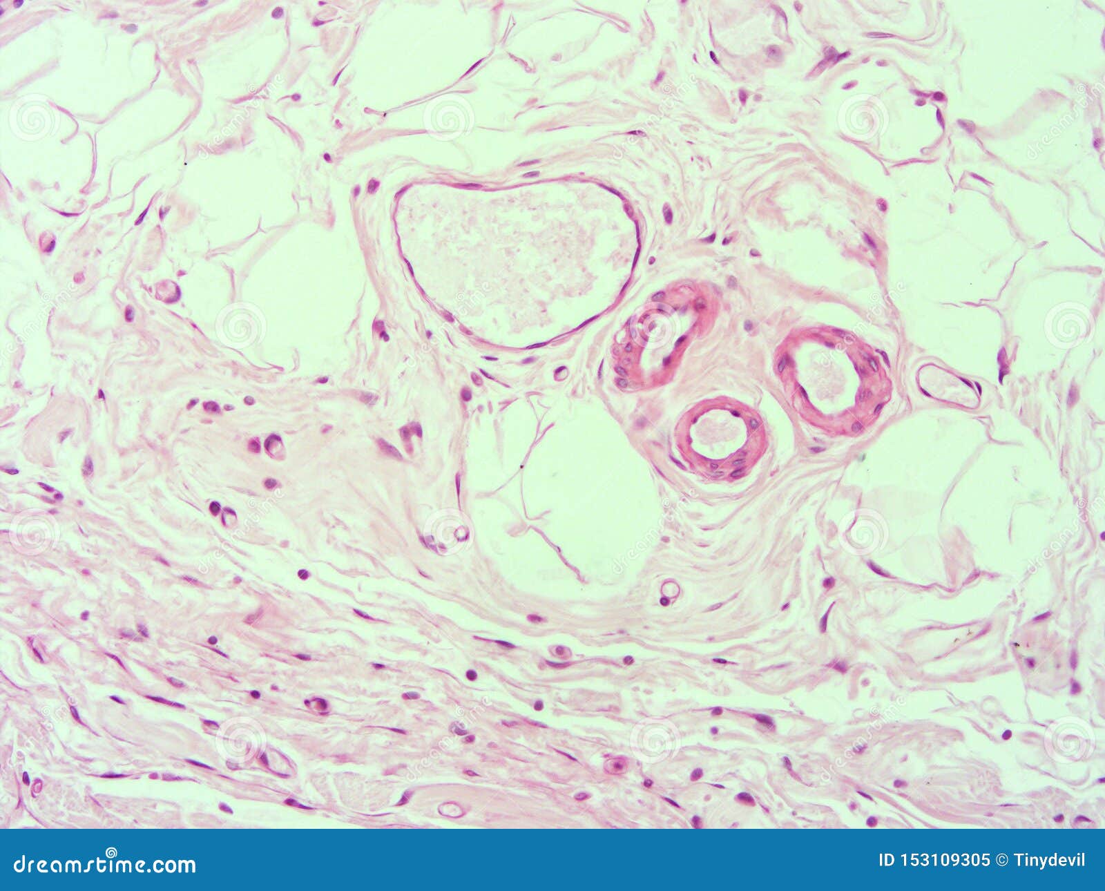 Histology of Human Gallbladder Tissue Stock Image - Image of cell ...