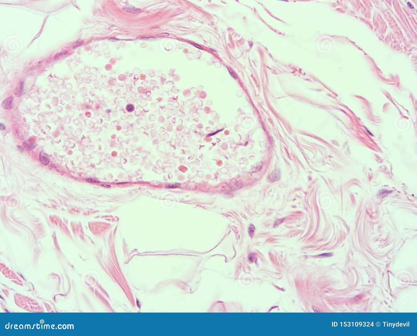 Histology of Human Gallbladder Tissue Stock Photo - Image of pathology ...