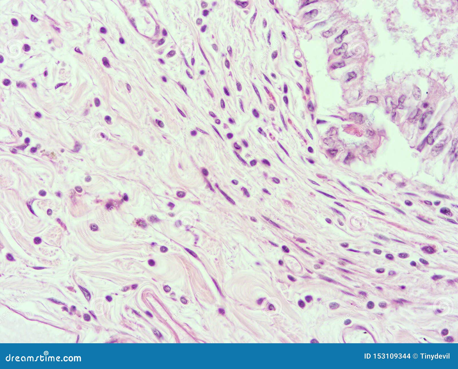 Histology of Human Gallbladder Tissue Stock Photo - Image of connective ...