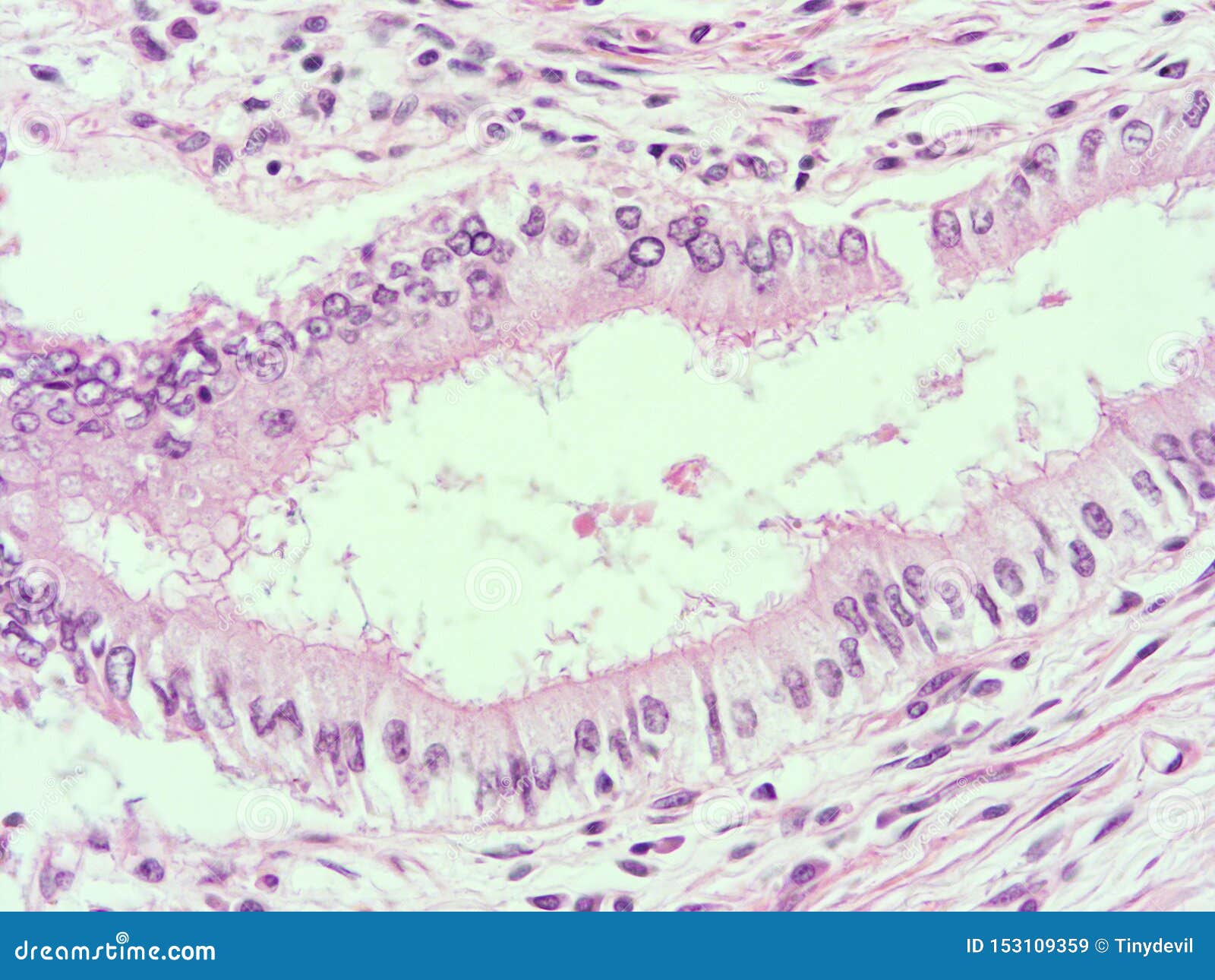 Histology of Human Gallbladder Tissue Stock Image - Image of epithelium ...