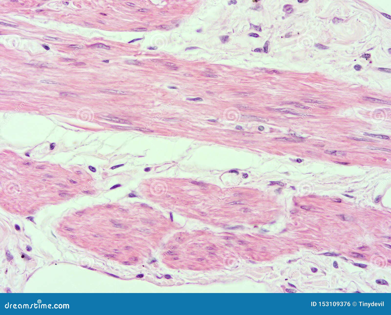 Histology of Human Gallbladder Tissue Stock Photo - Image of health ...