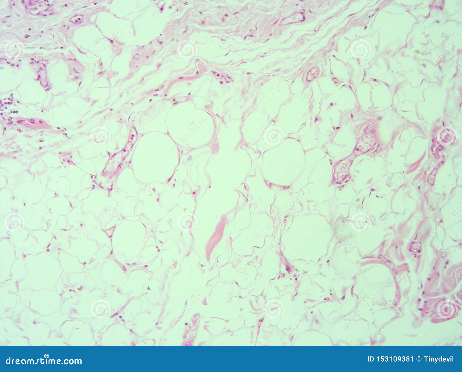 Histology of Human Gallbladder Tissue Stock Image - Image of health ...
