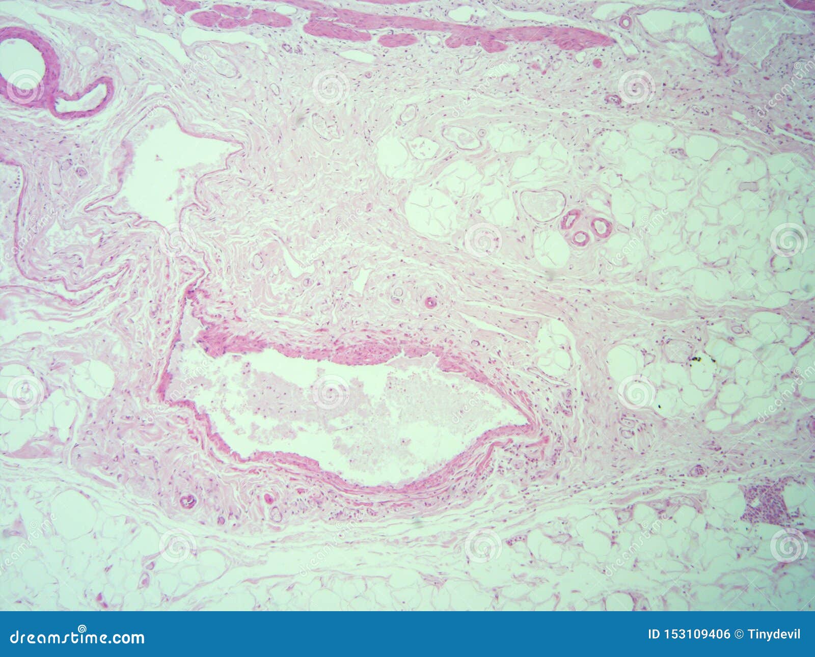 Histology of Human Gallbladder Tissue Stock Photo - Image of medical ...