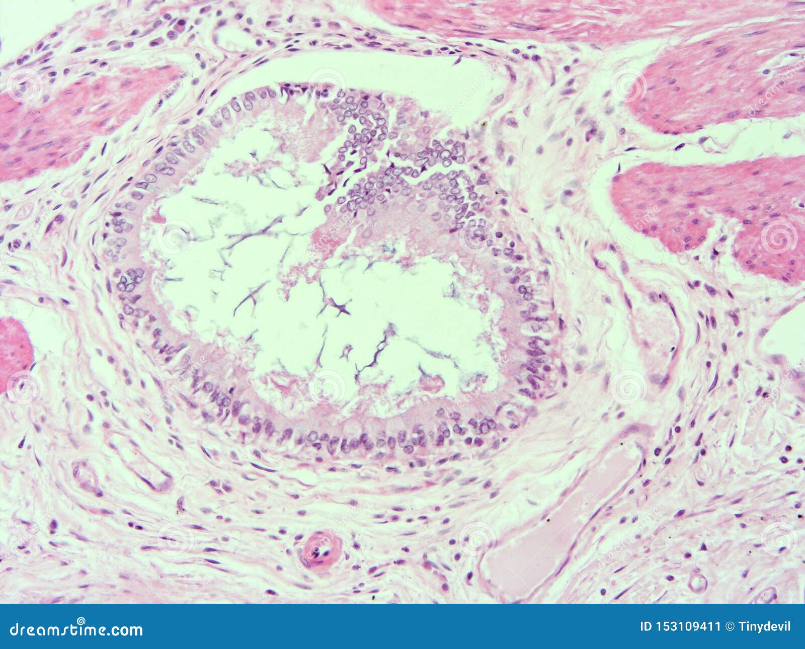 Histology of Human Gallbladder Tissue Stock Image - Image of kidney ...