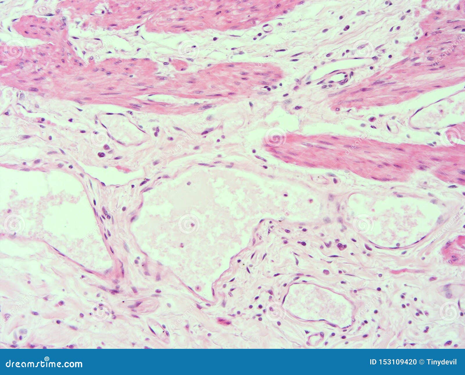 Histology of Human Gallbladder Tissue Stock Photo - Image of epiglottis ...
